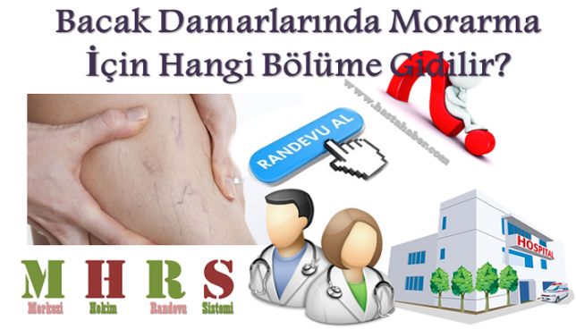 Bacak Damarlarında Morarma İçin Hangi Bölüme Gidilir? – HASTANE RANDEVU ...